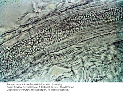 Dermatology Question of the Week: Deductive Dermpath | AccessMedicine ...