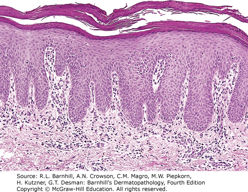 Dermatology Question of the Week: Deductive Dermpath | AccessMedicine ...
