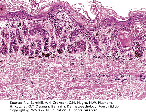 Dermatology Question of the Week: Deductive Dermpath | AccessMedicine ...