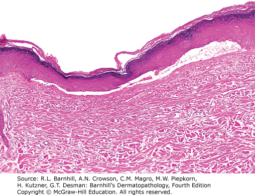 Dermatology Question of the Week: Deductive Dermpath | AccessMedicine ...