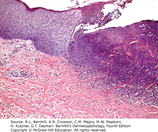 Dermatology Question of the Week: Deductive Dermpath | AccessMedicine ...