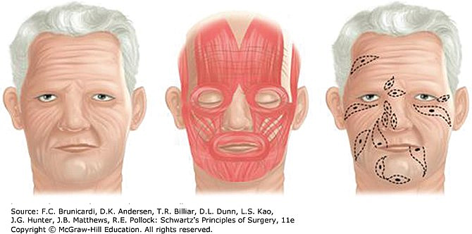 Facial Soft Tissue Trauma | AccessMedicine Network