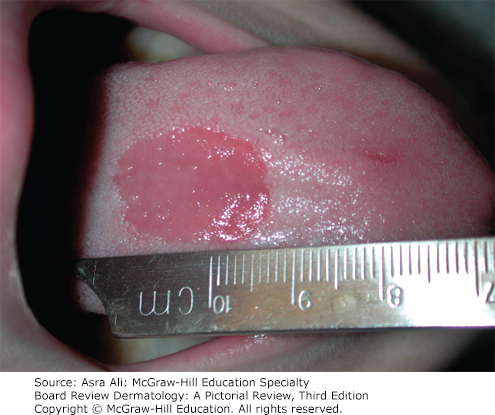 Dermatology Question of the Week: Deductive Dermpath | AccessMedicine ...